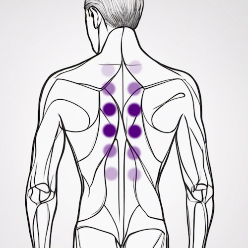 Modřiny po baňkování | Proč vznikají a k čemu slouží? | VERKA.CZ